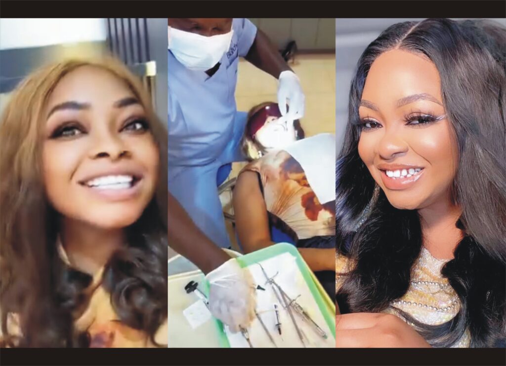 Nollywood Actress, Funmi Awelewa Undergoes Veneer Surgery to get Brand ...